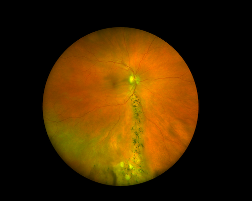 Duke Ophthalmic Photographers Earn Top Awards | Duke Department Of ...